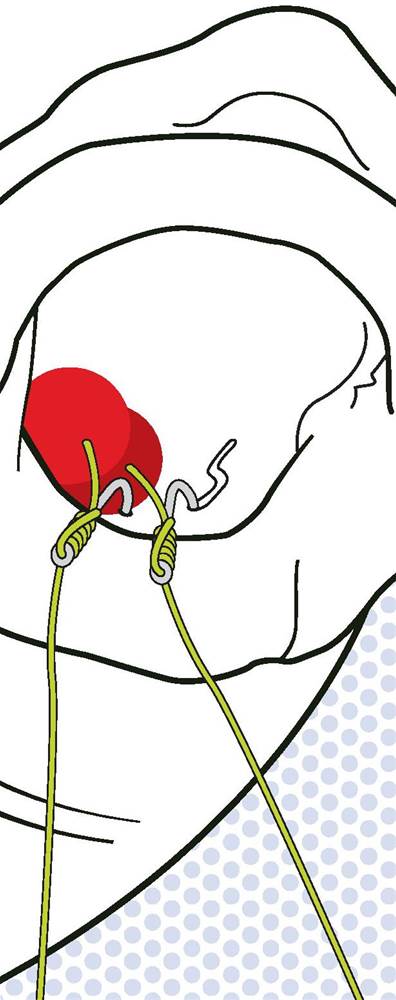 Analysing Hook Holds | CARPology Magazine Issue 222—May